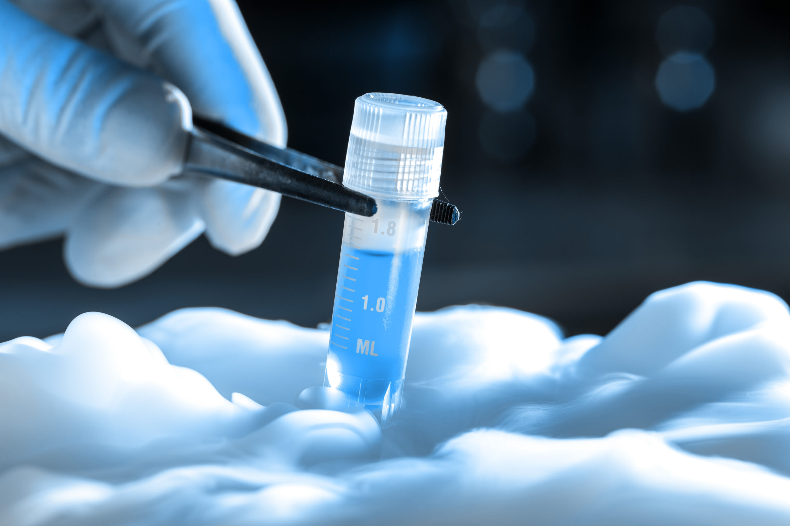 Congelación de semen | Procrea