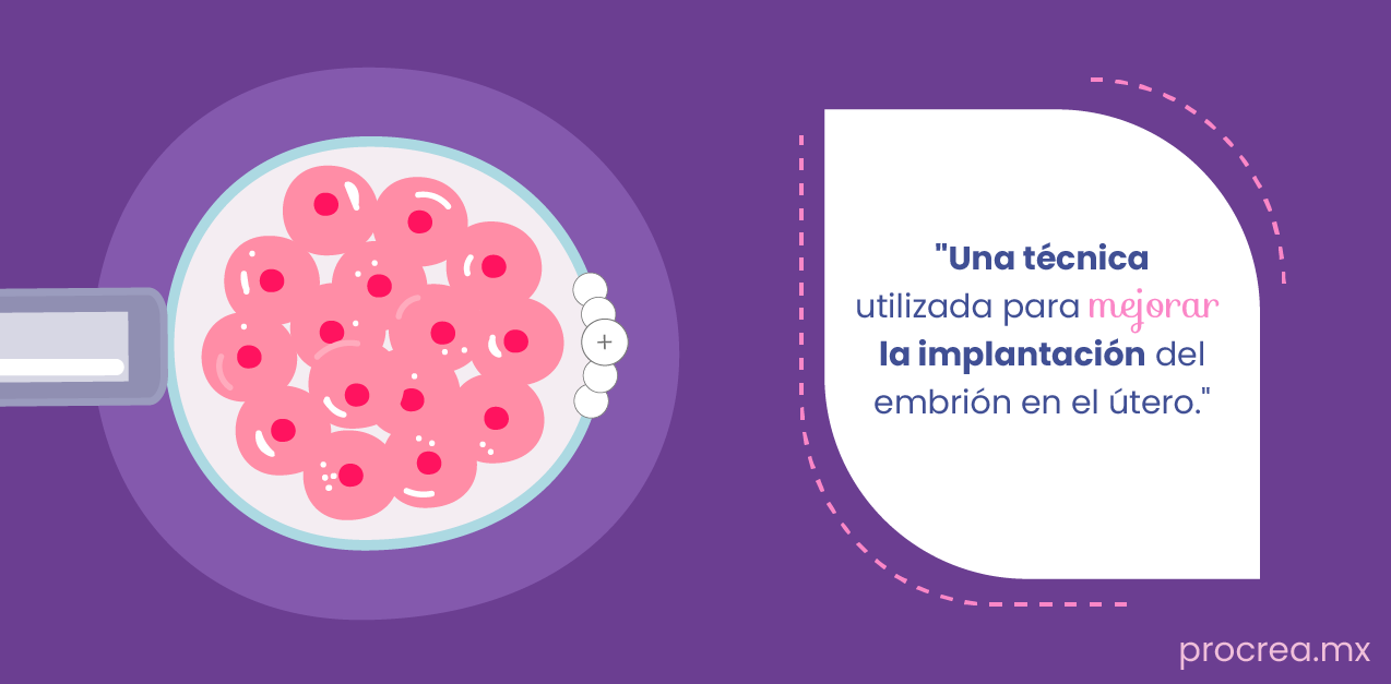 ¿Qué es la eclosión asistida? | Procrea