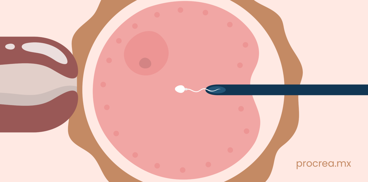 Fertilización in Vitro: ¿Qué es, cómo y en dónde se realiza? | Procrea